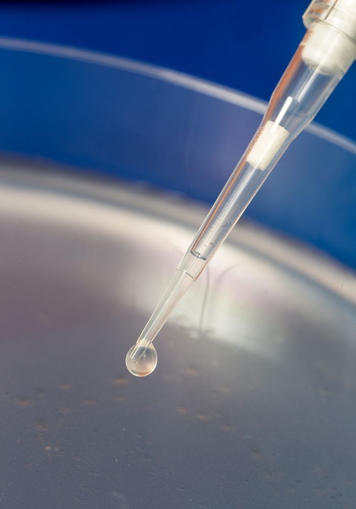 Har funnet en mal for å identifisere genene som gjør oss syke. Nå ...